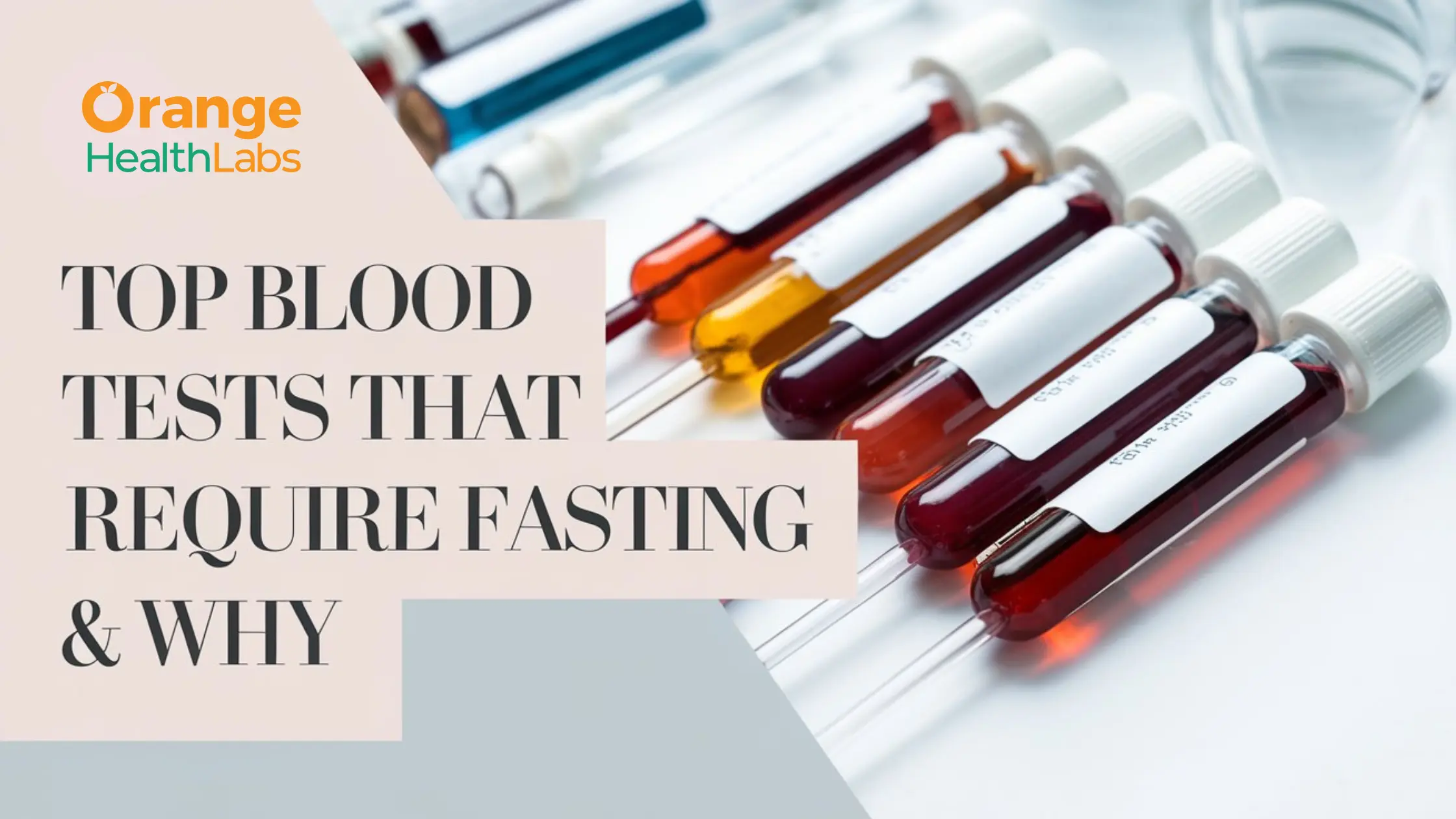 How Blood Tests Are Conducted - Collection to Lab Report